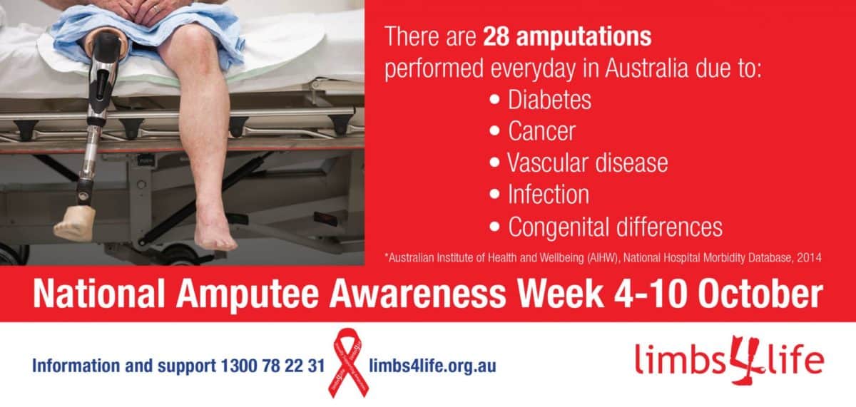 Get Your Ribbon On: National Amputee Awareness Week | ConnectAbility ...